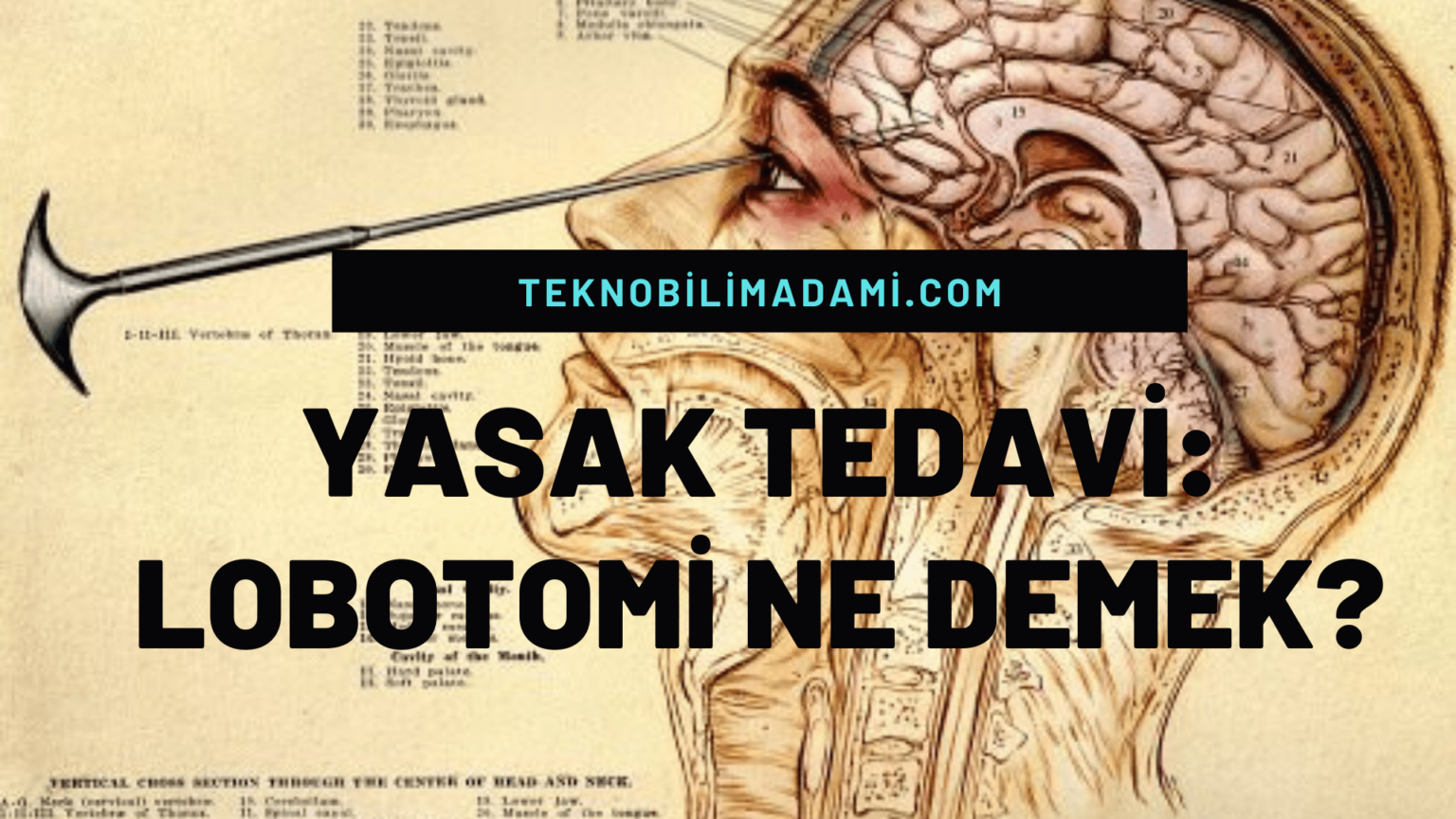 Yasak Tedavi: Lobotomi Ne Demek? 2021 - Tekno Bilim Adamı